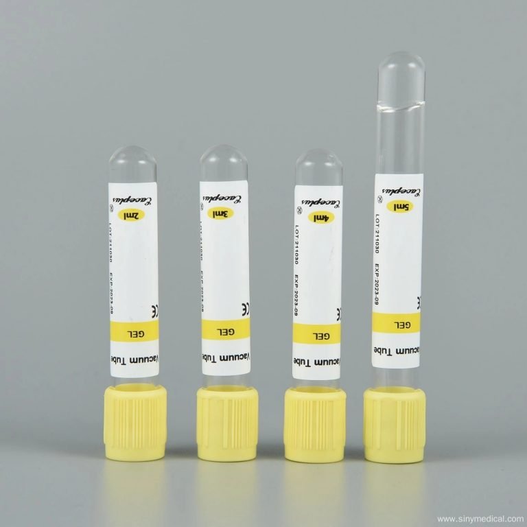 What is the ESR Tube Color? | A Complete Guide and Testing