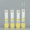 Differences Between Red and Yellow Cap Blood Tubes at Siny