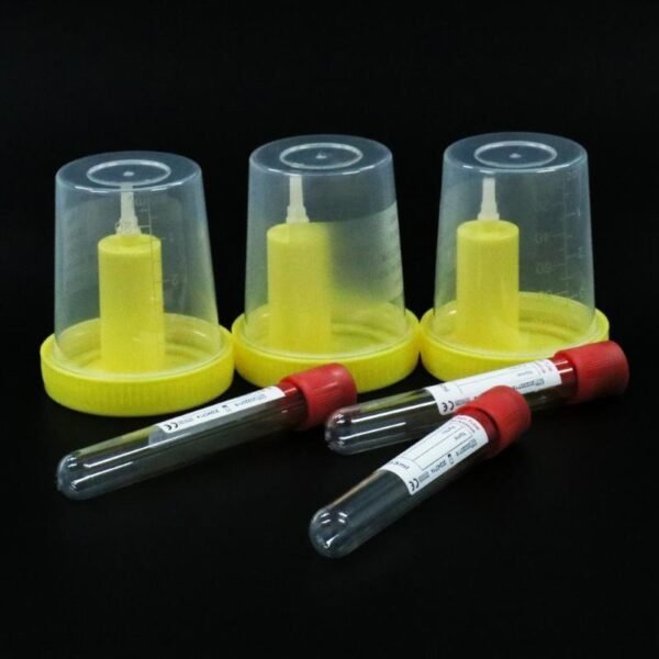Sterile Vacuum Urine Cup with Collection Tube | Affordable Pricing