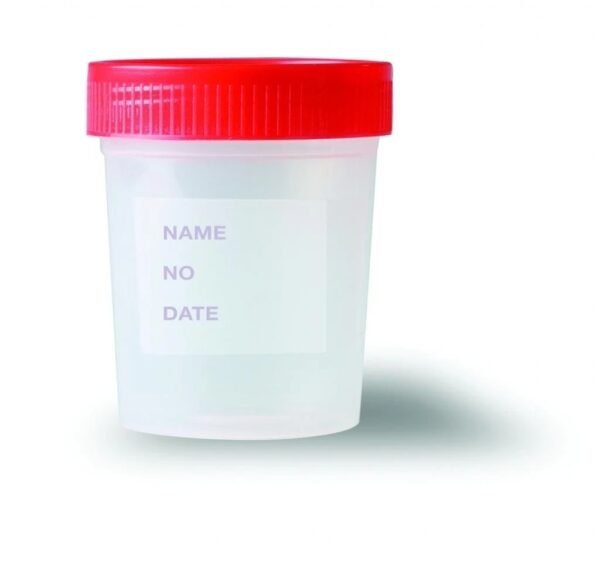 Siny Hospital Disposable Stool Sample Cup - Sterile