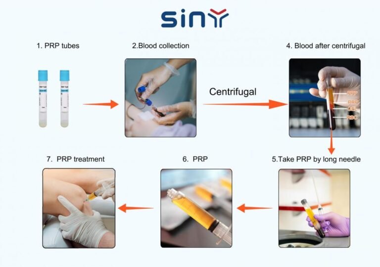 What Type of Blood Collection Tube is used to Extract PRP?