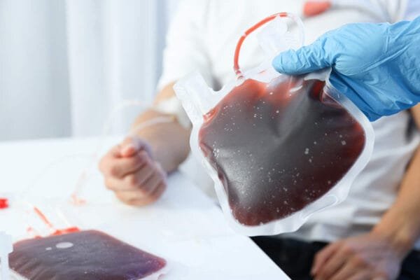Safe and Sterile Blood Collection with Single Blood Bag
