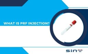 PRF Injections: The Ultimate Guide to Benefits and Techniques