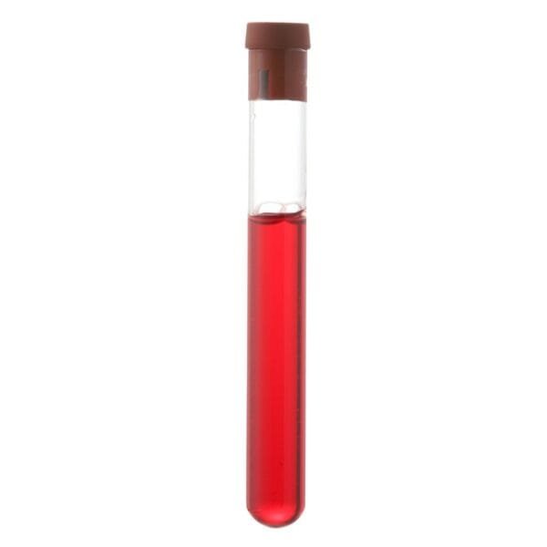 What Is a Total General Bacteria Detection Tube Practical Guide